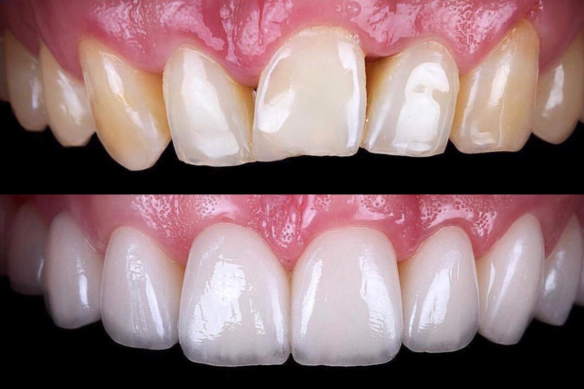 M DENTALIS Stomatolo ka Ordinacija Estetska Stomatologija M DENTALIS Stomatolo ka Ordinacija Estetska Stomatologija
